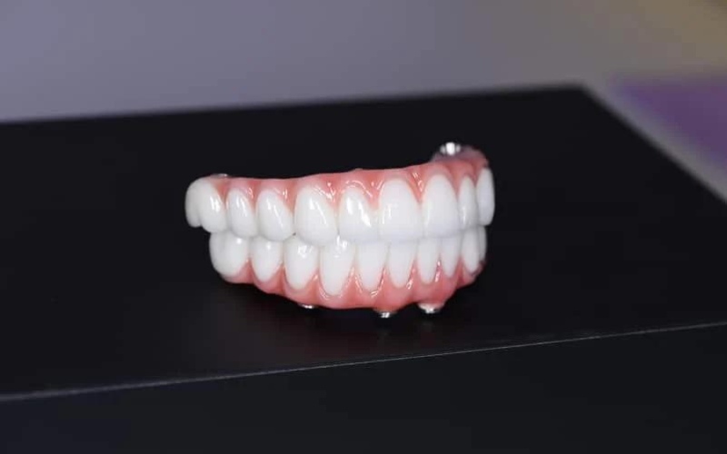 Fixed Full Arch Teeth with All-On-4 Plus® | Dental Couture